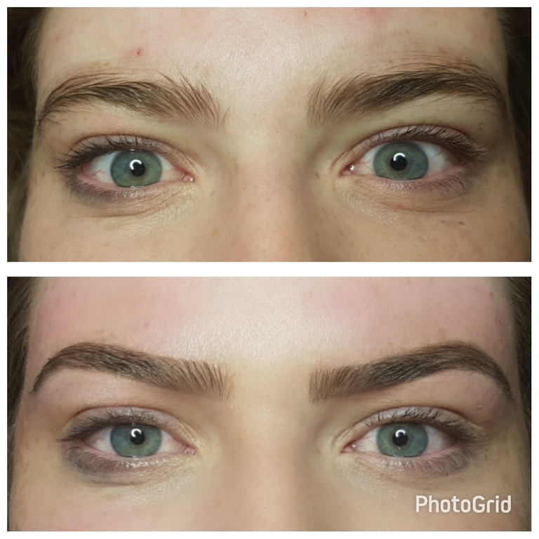 8 Stunning Examples of Before And After Eyebrow Treatment - The Eyebrow ...